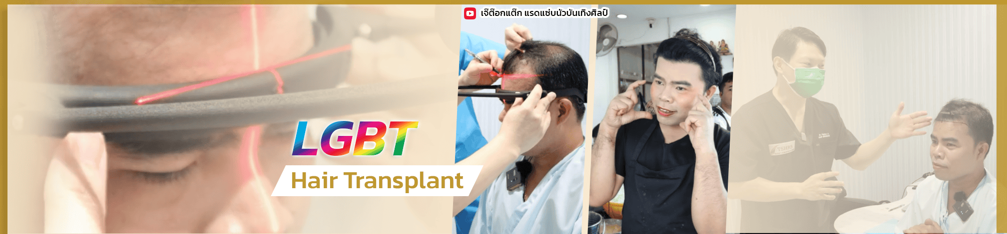 Transgender Hair Transplant - Ultima Hair Transplant Thailand