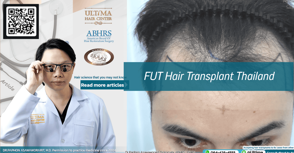 FUT Hair Transplant Thailand